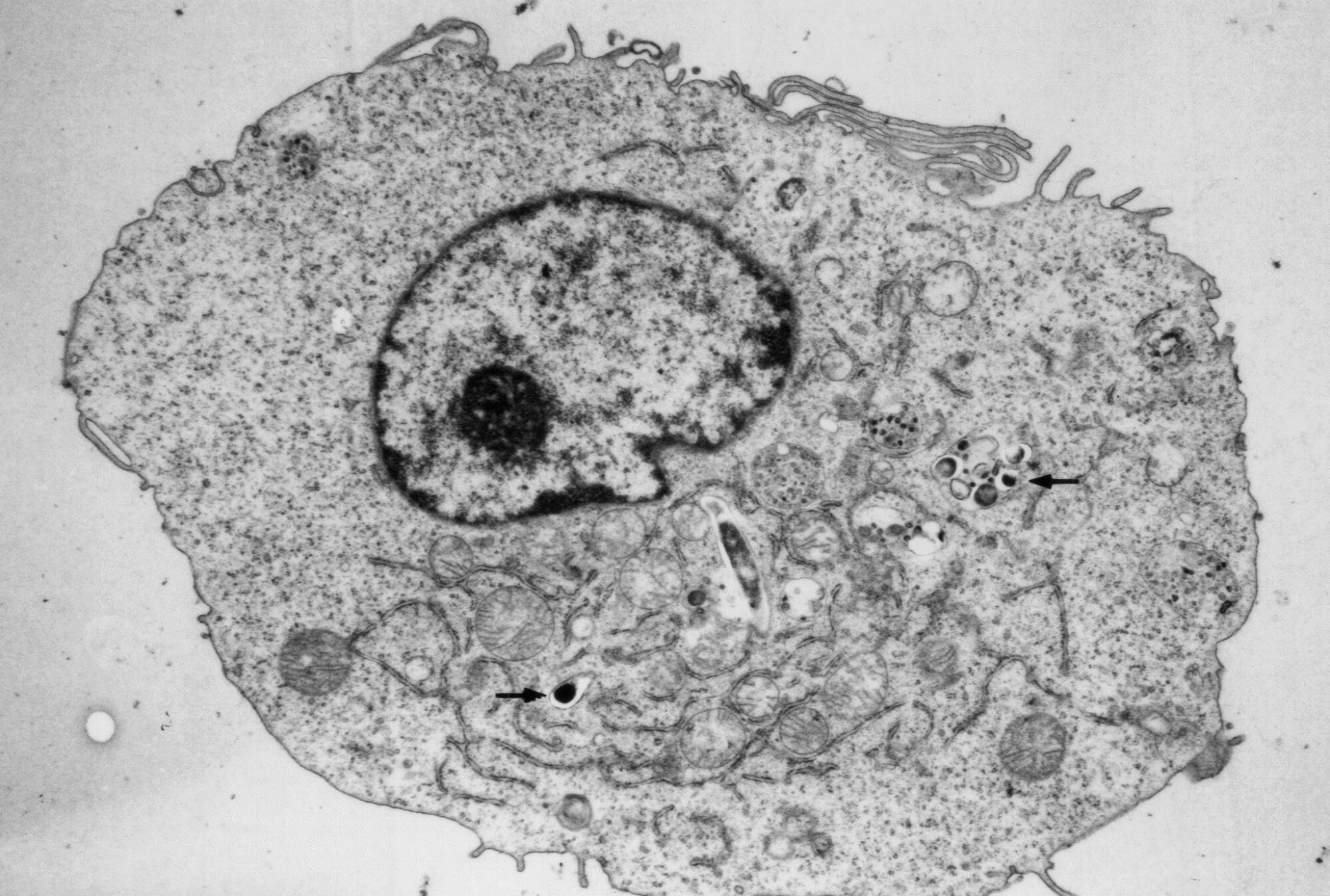 Cutting-Edge Methods in Physics for Studying Intracellular Bacterial ...